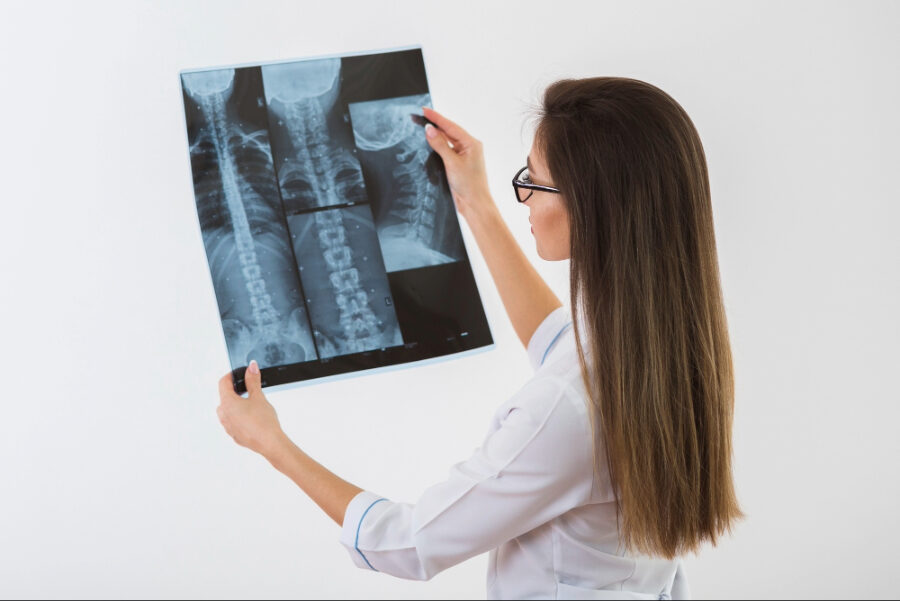 Scoliosis Symptoms Explained | How to Detect Them at Any Age